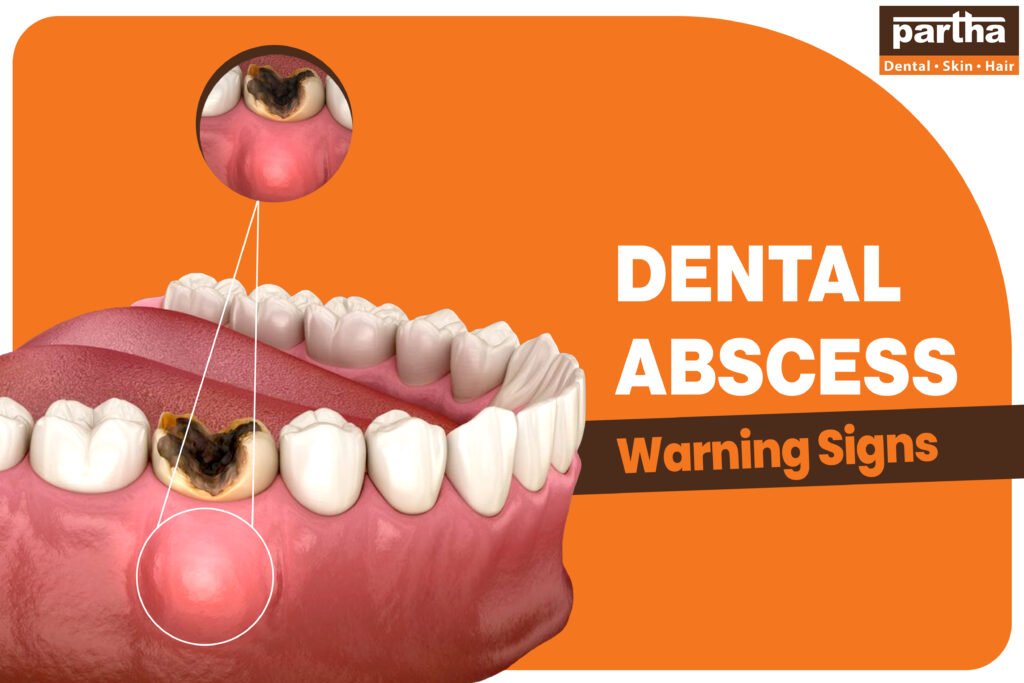 Dental Abscess Treatment | Warning Signs, Care & Cost Guide