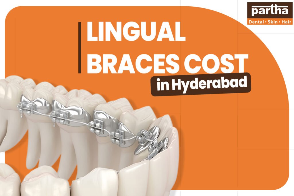 Lingual Braces Cost In Hyderabad | Hidden Braces Price Guide