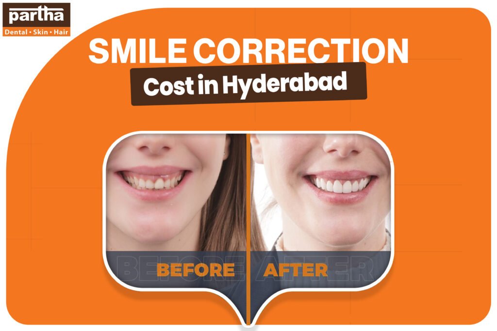 Smile Correction Cost In Hyderabad | Expert Care