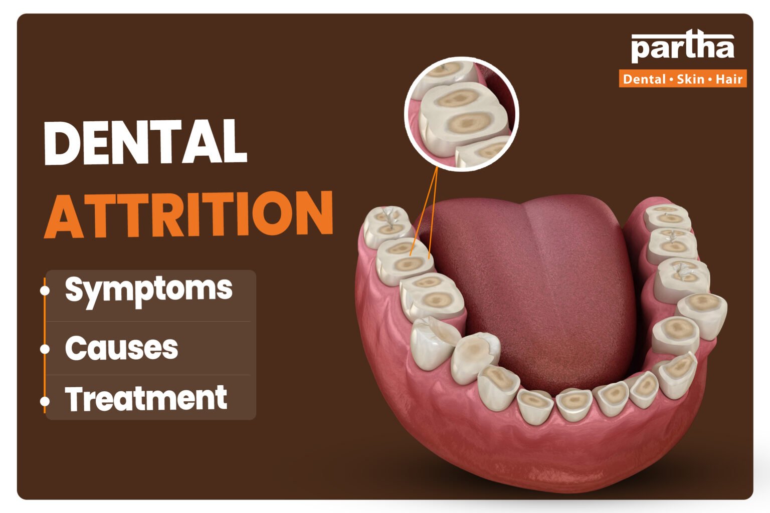 Dental Attrition: Symptoms, Causes & Treatment Options