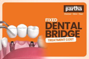 Fixed Dental Bridge Treatment | Cost, Process & Benefits Guide