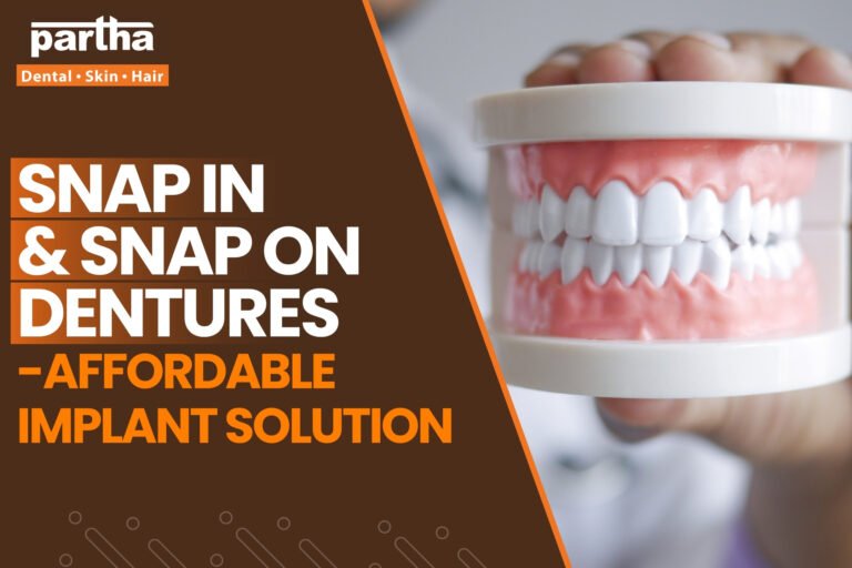 Snap In And Snap On Dentures – Affordable Implant Solution
