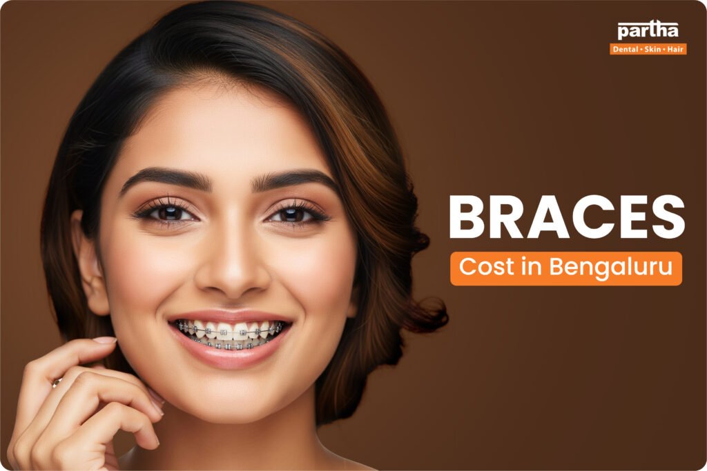 Braces Cost In Bangalore | Types, Price & Affordable Options
