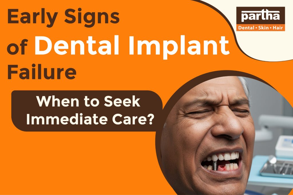 Early Signs Of Dental Implant Failure | Symptoms & Prevention