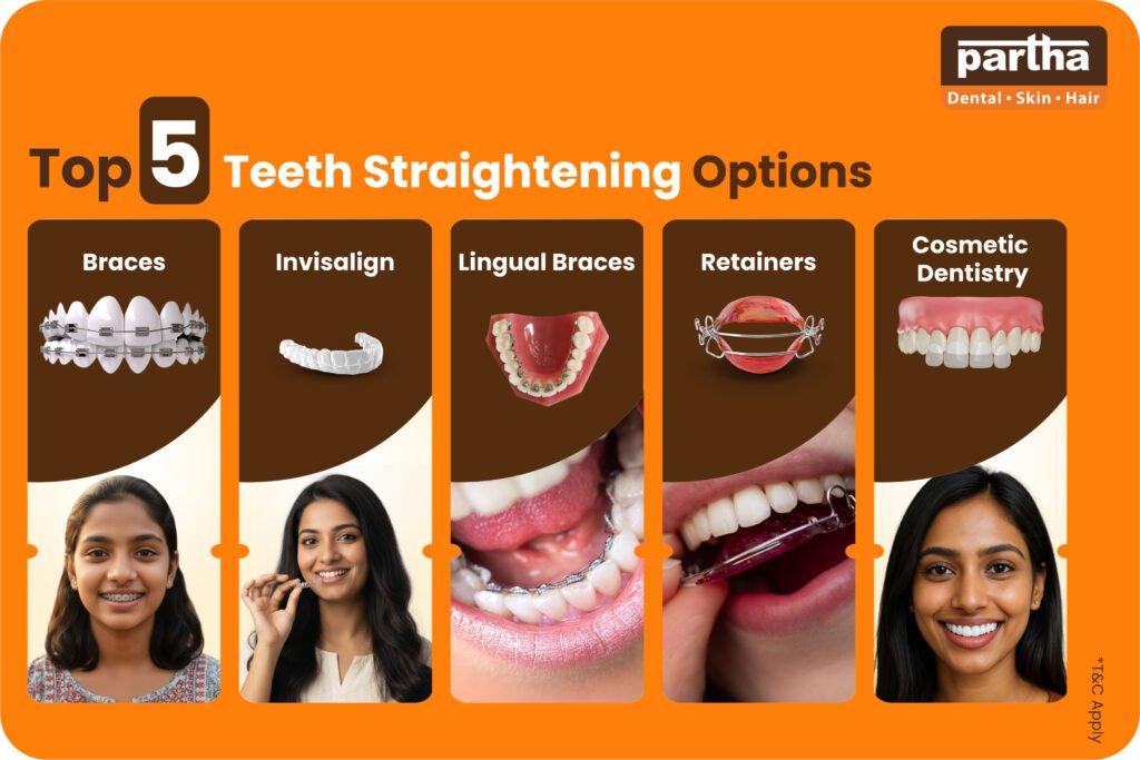 Top 5 Teeth Straightening Options To Correct Your Smile