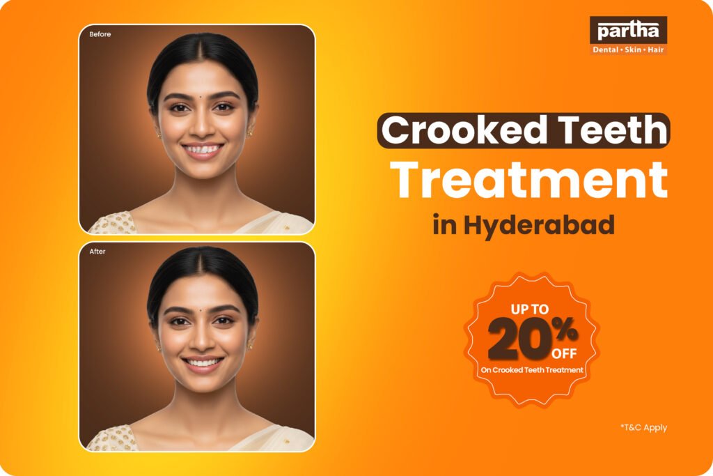 Crooked Teeth Treatment In Chennai | Straighten Your Smile