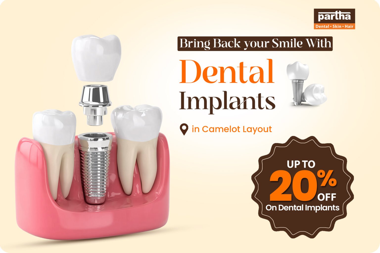 Dental Implants In Camelot Layout | Partha Dental