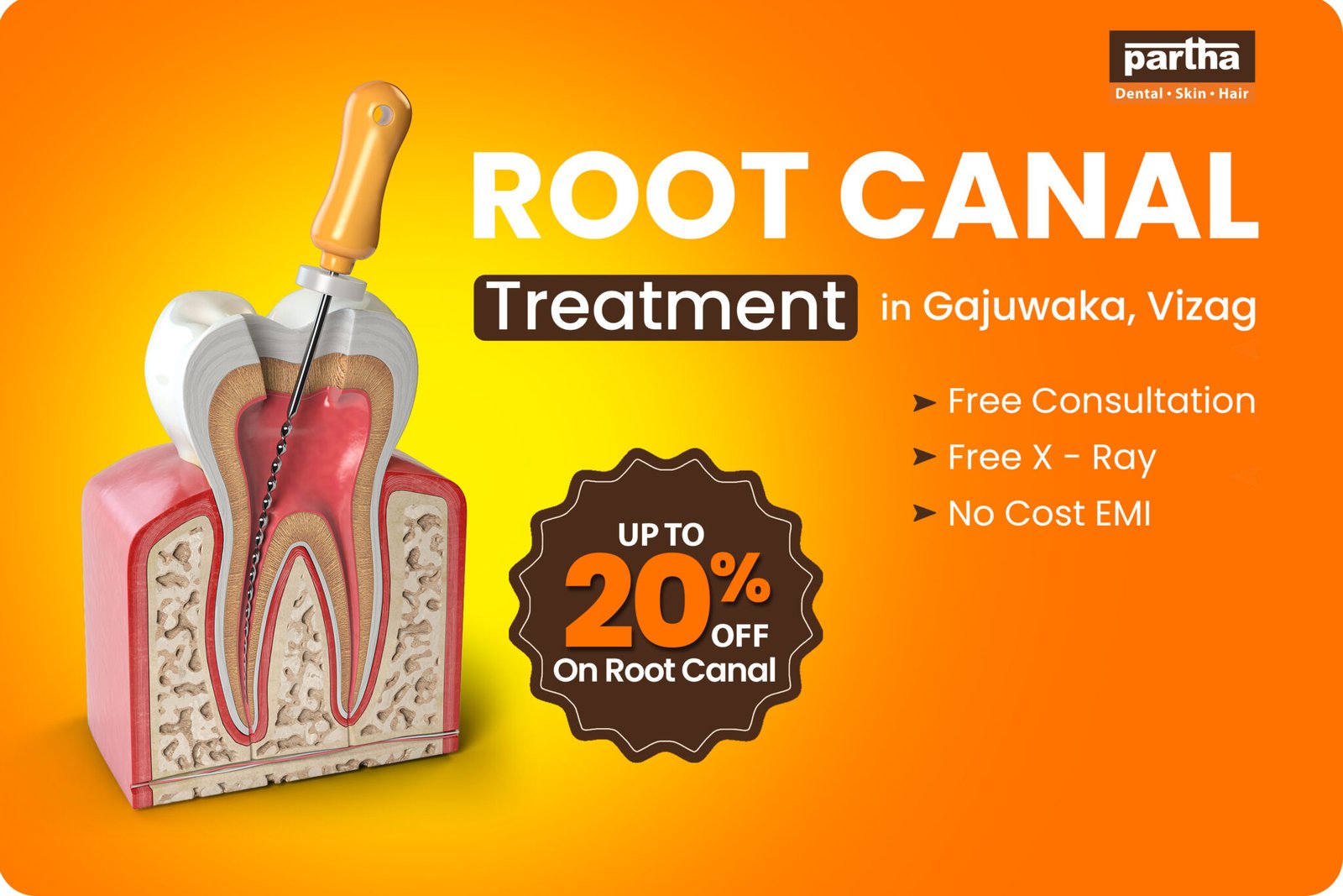 Best Root Canal Treatment In Gajuwaka, Vizag - Partha Dental