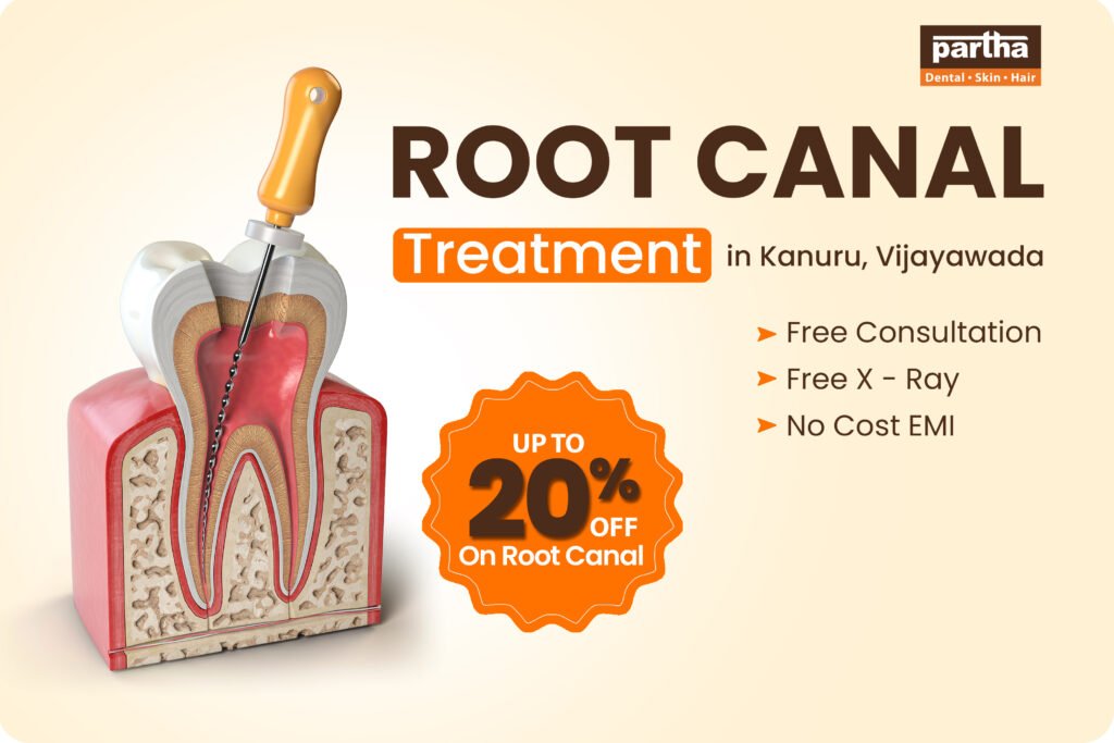 Expert Root Canal Treatment In Kanuru | Partha Dental