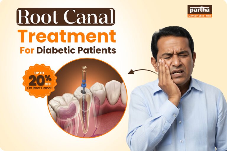 Root Canal Treatment For Diabetic Patients - Is It Safe?