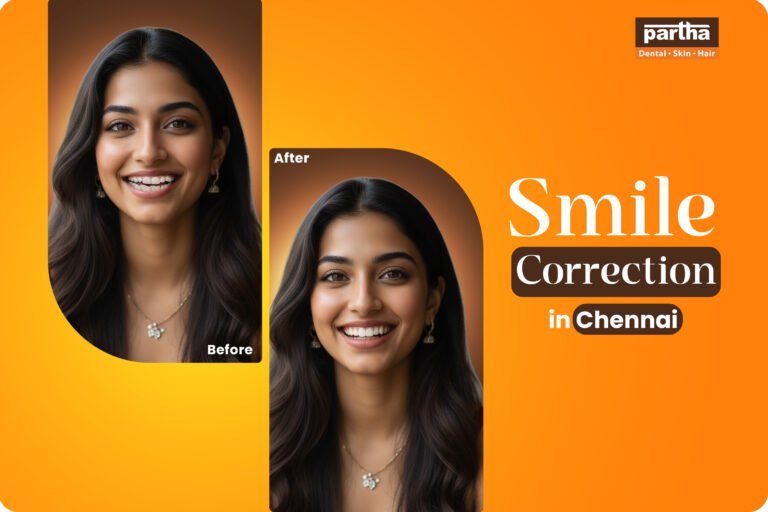 Best Smile Correction Treatment In Chennai | Perfect Smile