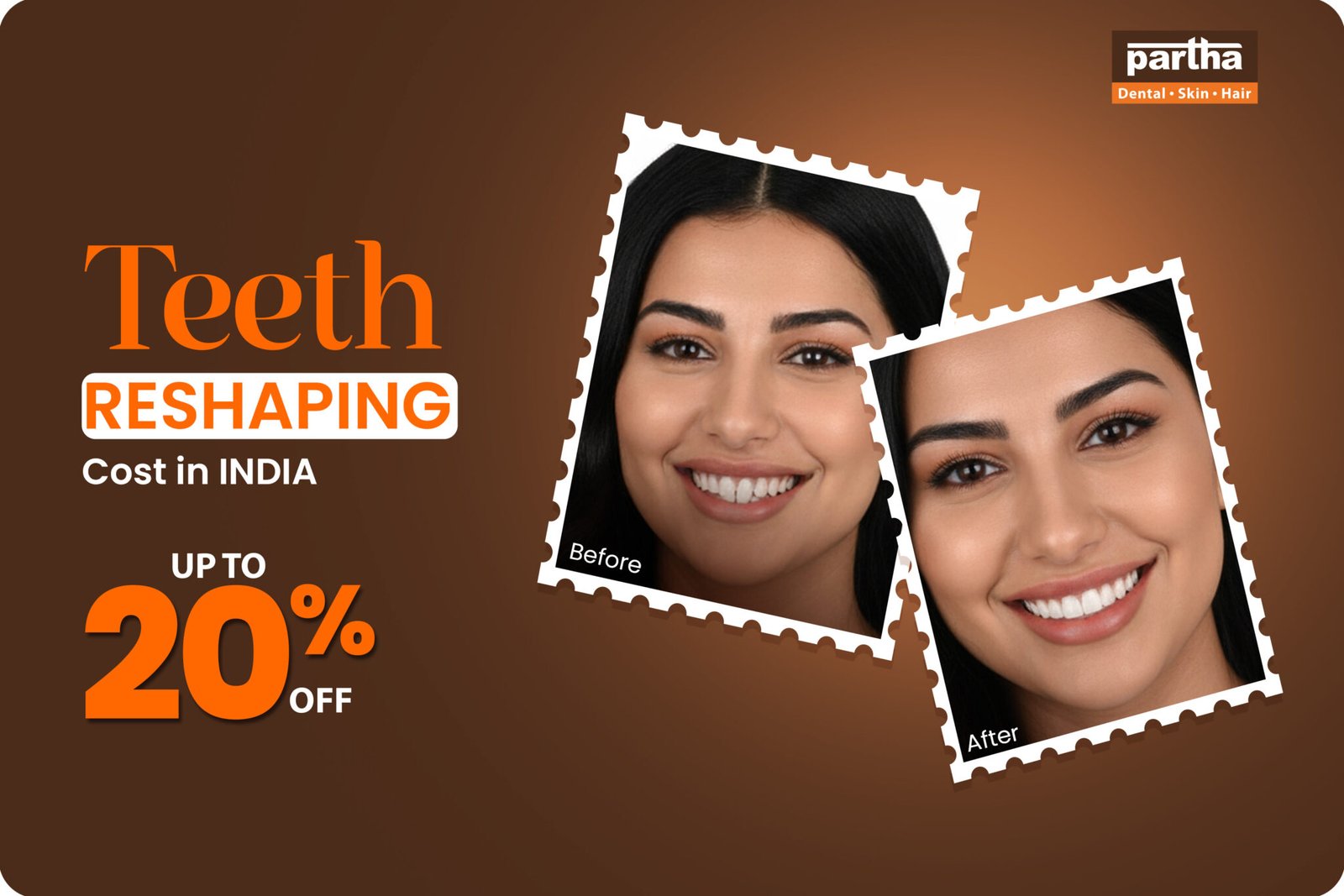 Teeth Reshaping (Tooth Contouring) Benefits & Cost In India