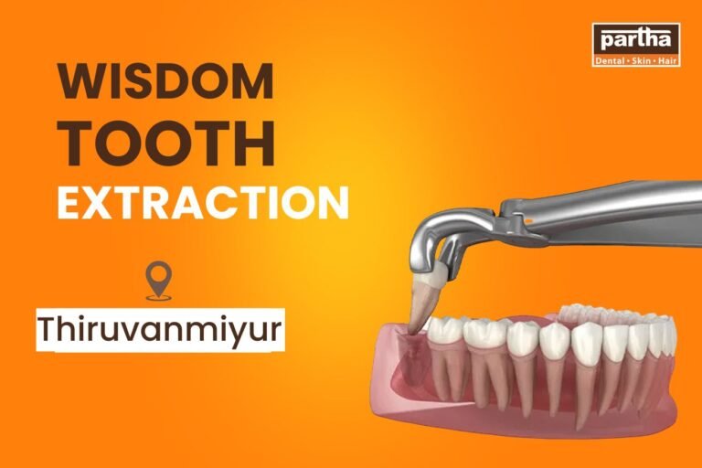 Wisdom Teeth Extraction In Thiruvanmiyur | Painless Surgery