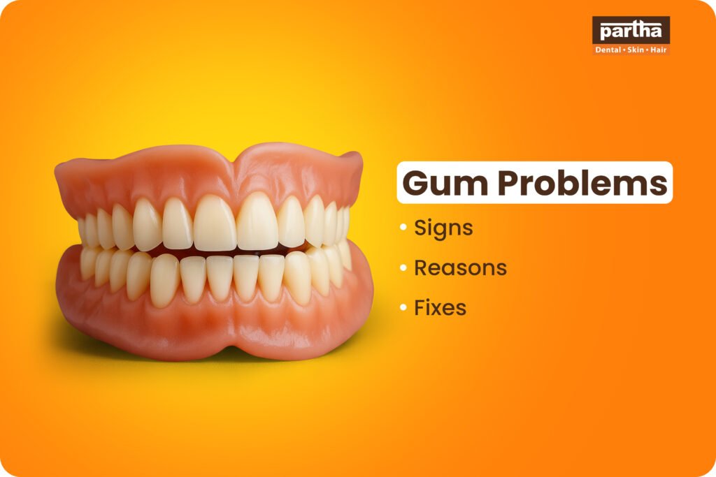 What Stops Gum Problems? Signs, Reasons, Also Fixes. - Partha Dental Hair