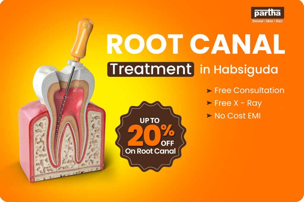 Painless Root Canal In Habsiguda | Partha Dental