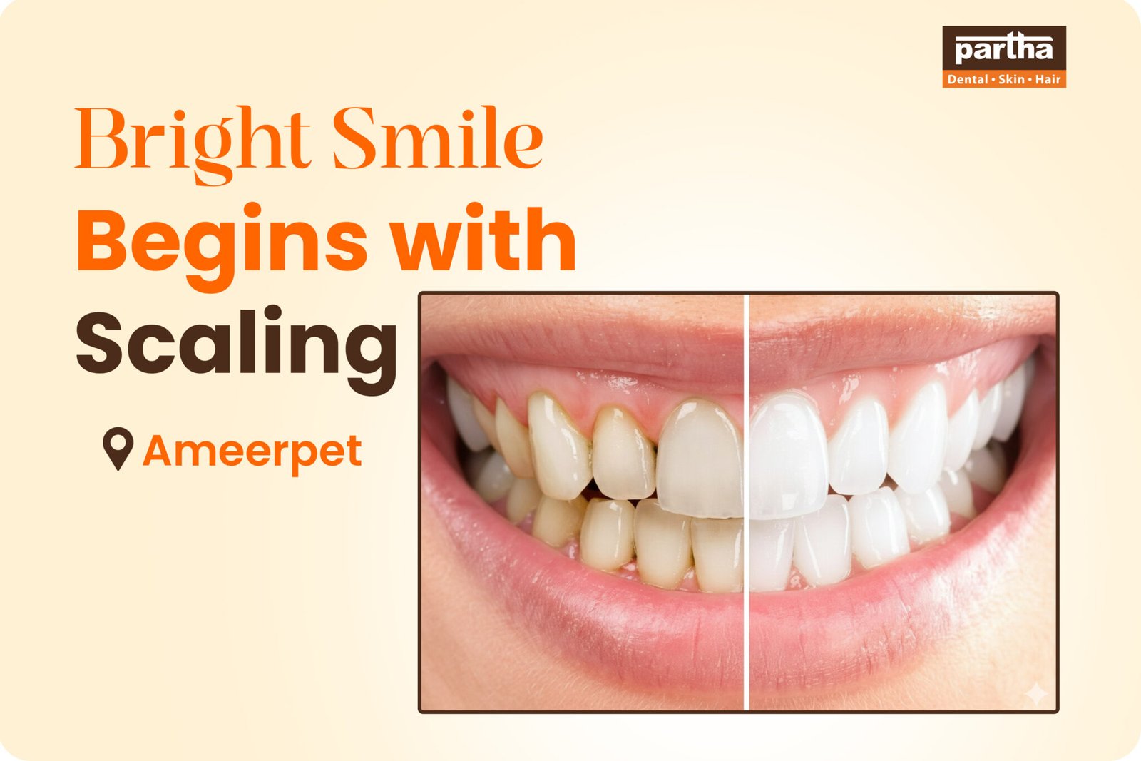 Teeth Scaling Treatment In Ameerpet | Partha Dental Clinic