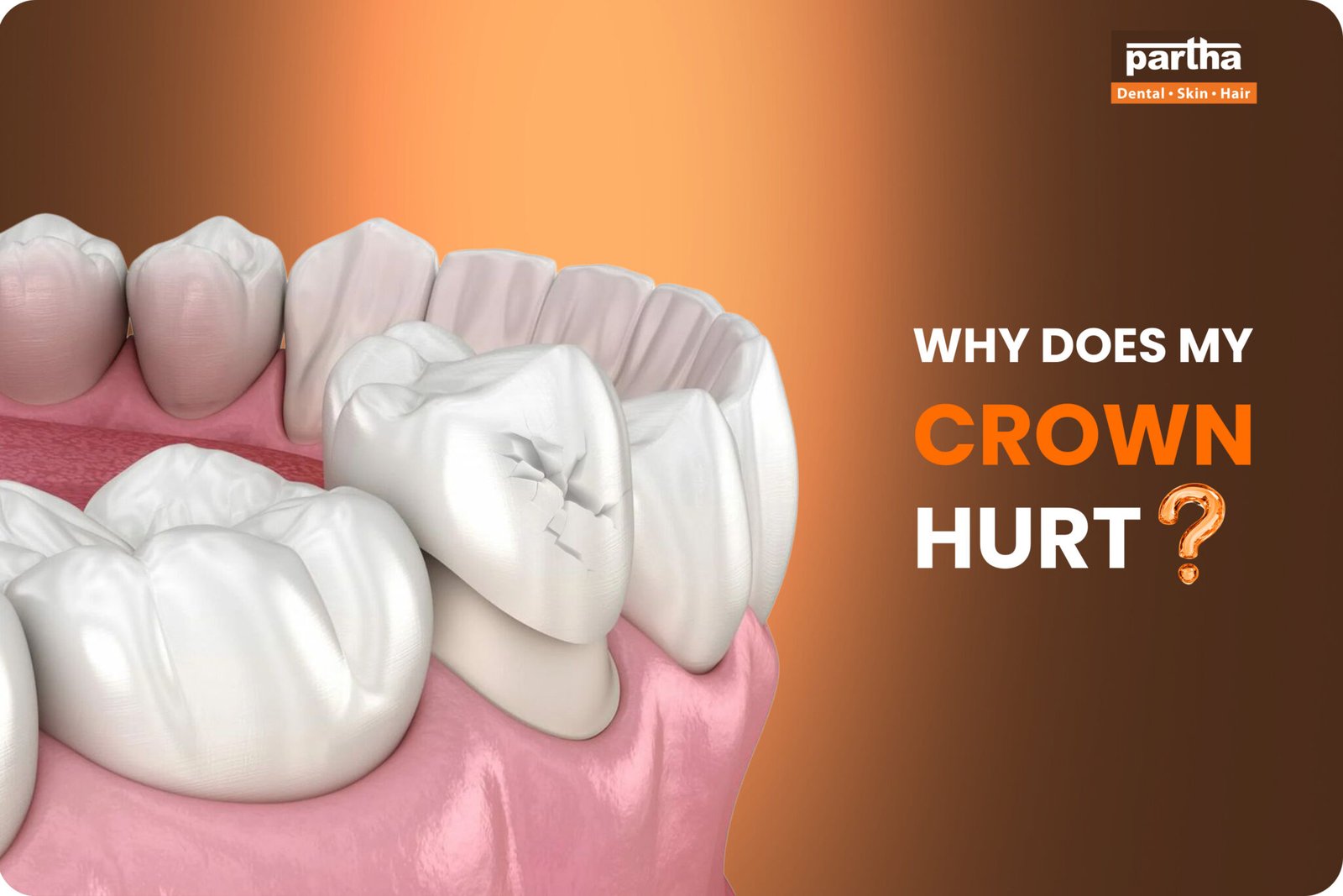 Why Does My Dental Crown Hurt? Causes & Relief Tips