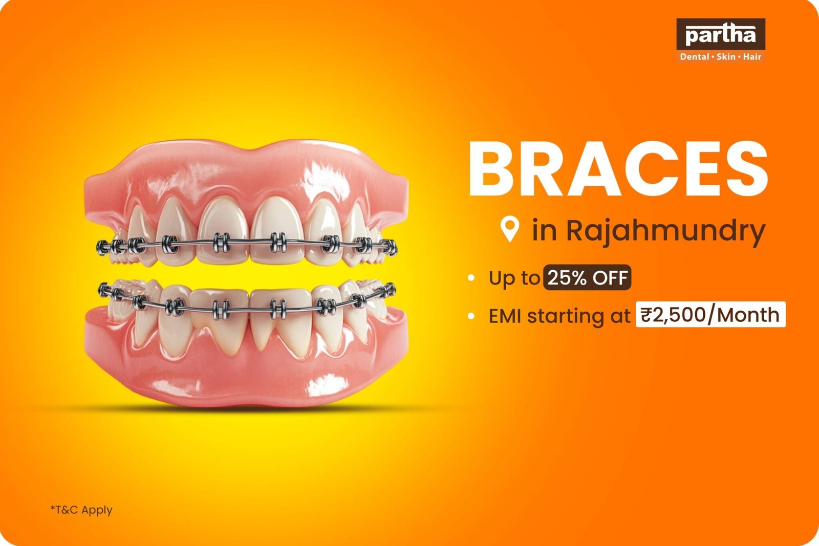 Tooth Braces In Rajahmundry | Advanced & Affordable Braces Care