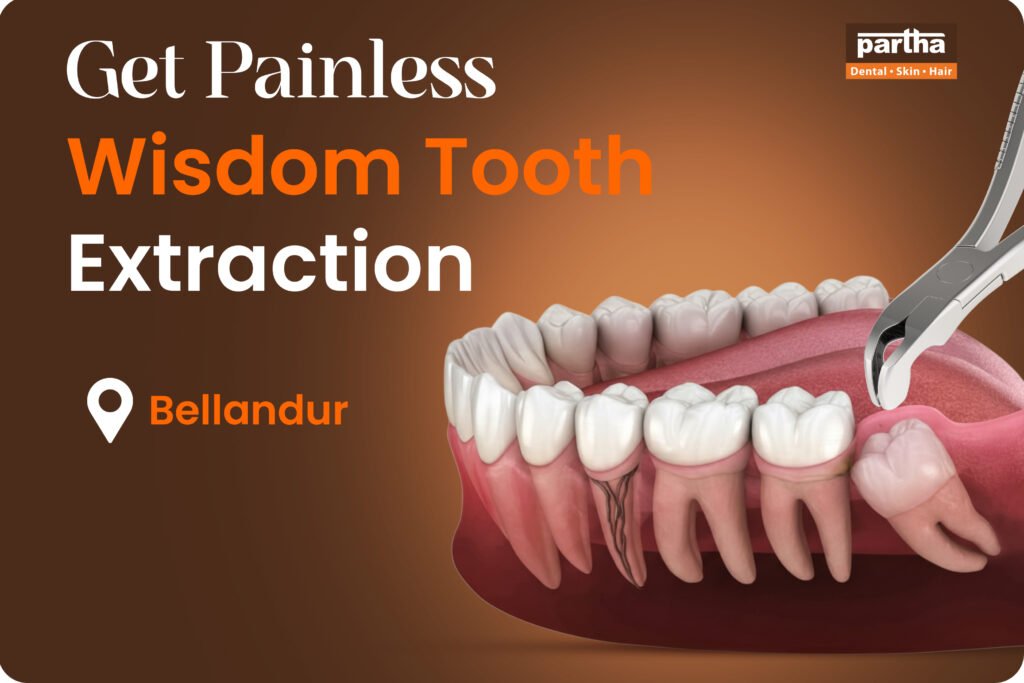 Wisdom Tooth Removal Treatment In Bellandur