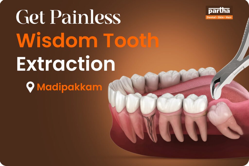 Advanced Wisdom Teeth Extraction In Madipakkam | Partha Dental