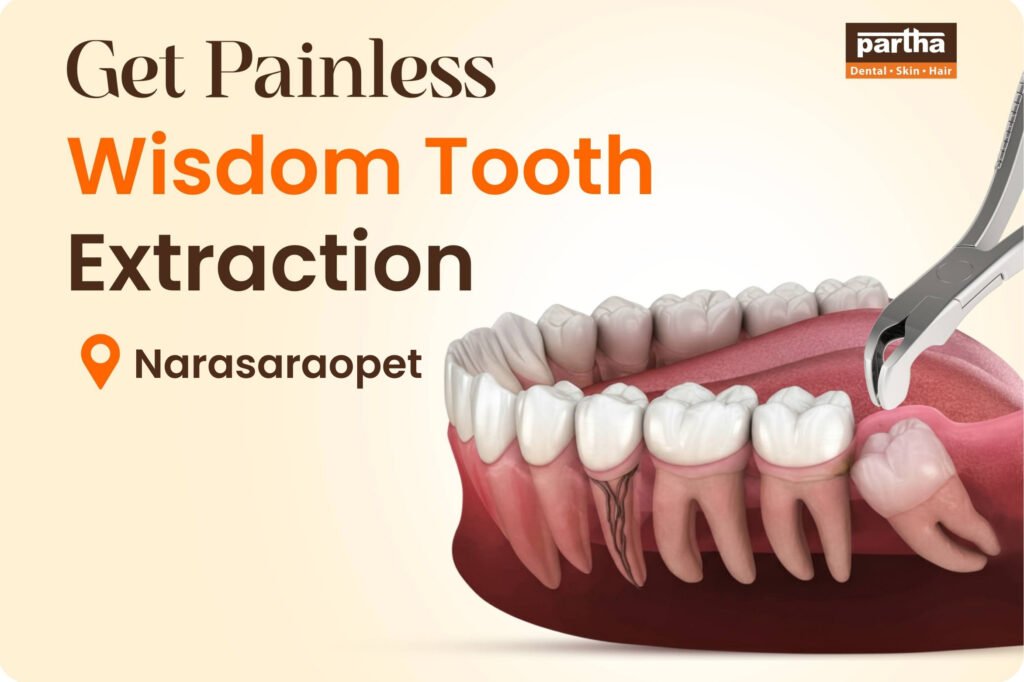 Wisdom Tooth Extraction In Narasaraopet | Partha Dental Care