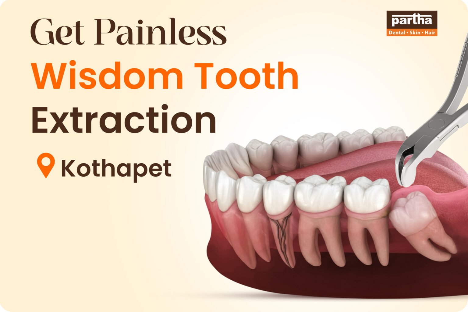 Get Wisdom Tooth Extraction In Kothapet, Dilsukhnagar