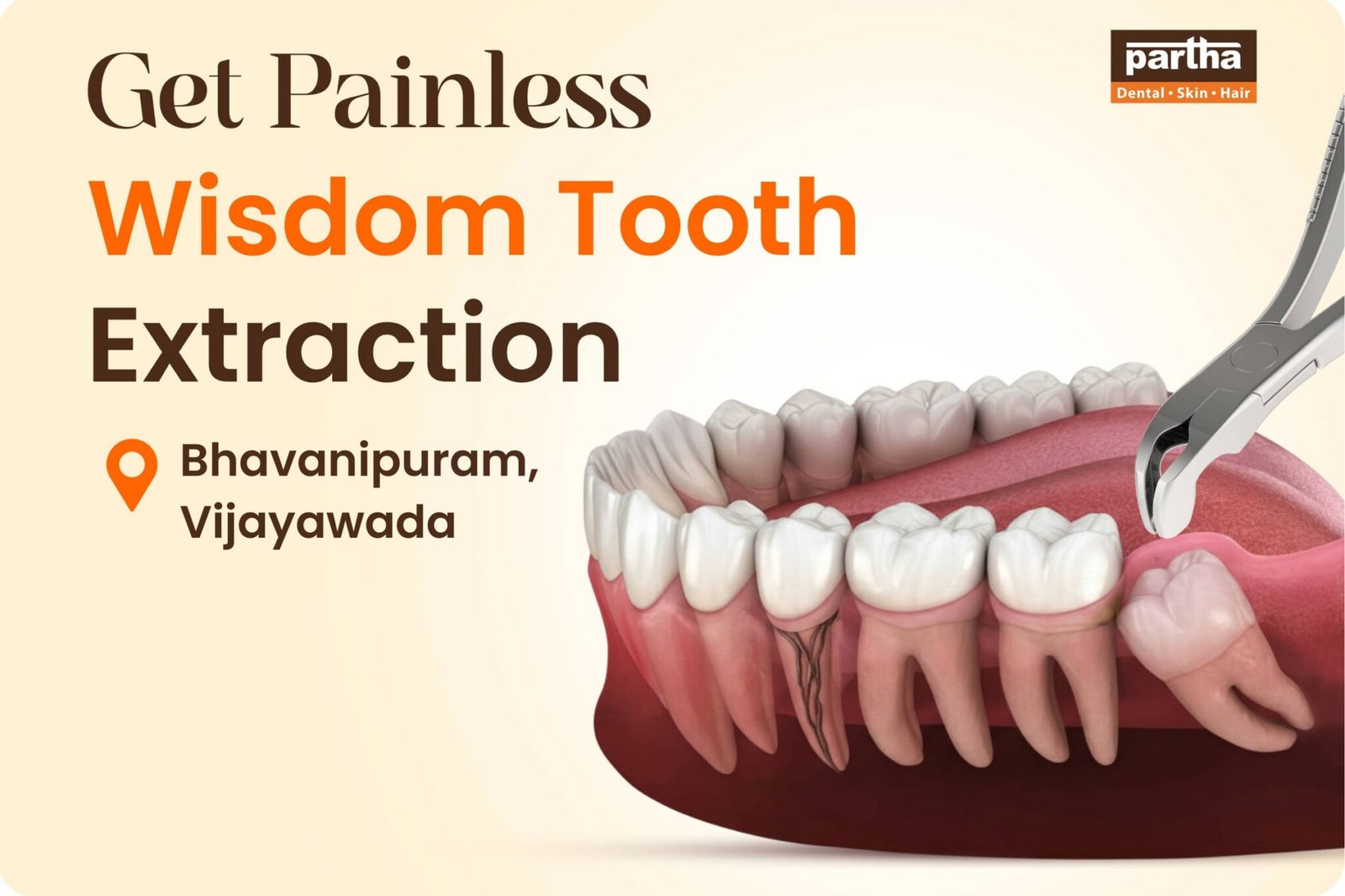 Wisdom Tooth Extraction In Bhavanipuram | Safe & Painless Care