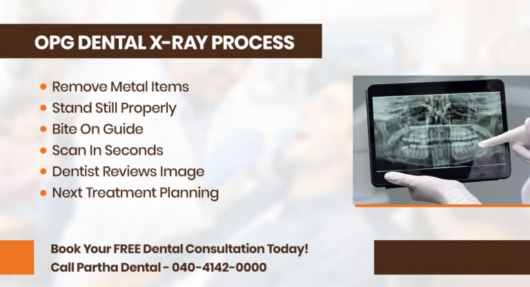 OPG Dental X-Ray Benefits And Process