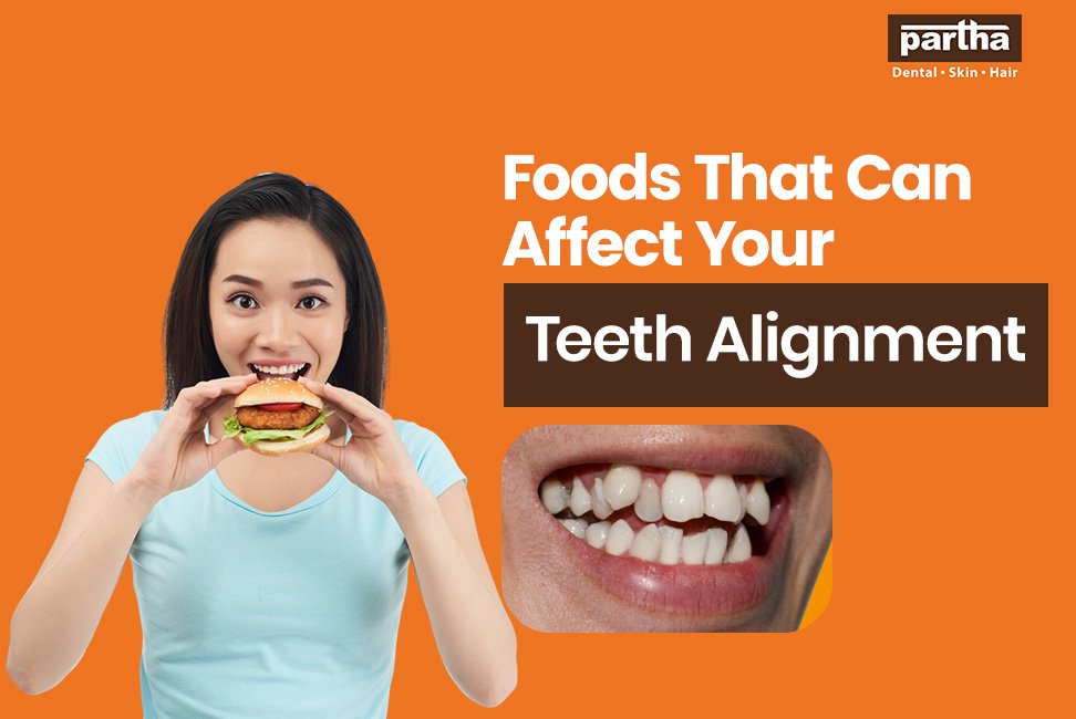 Active Vs Passive Dental Implants: Key Differences Explained