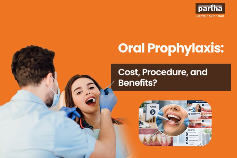 Oral Prophylaxis: Cost, Procedure And Benefits